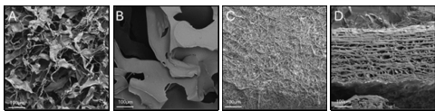 Dermal Matrices: What Features Matter Most for Time to Graft?